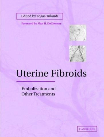 Uterine Fibroids - Labyrinth Books