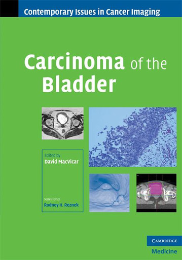 Carcinoma of the Bladder - Labyrinth Books
