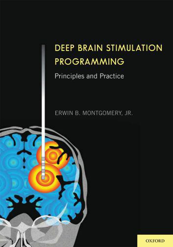 Deep Brain Stimulation Programming - Labyrinth Books