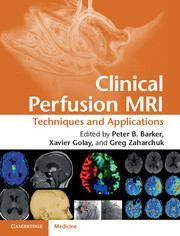 Clinical Perfusion MRI - Labyrinth Books