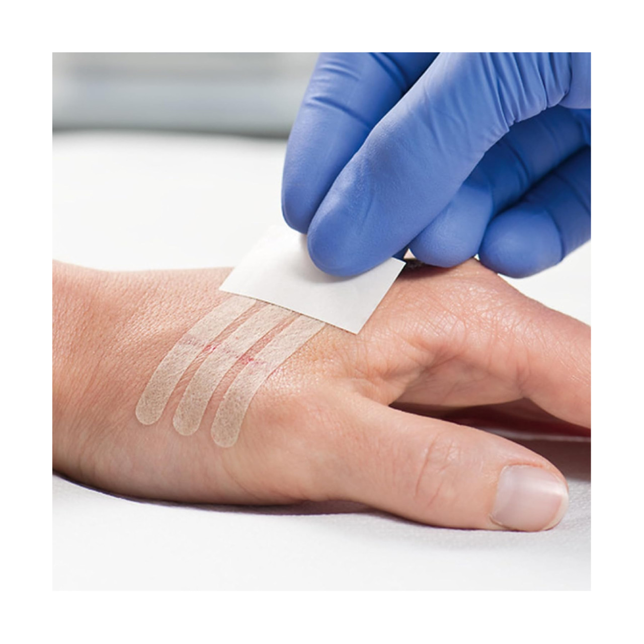 Omnistrip Closure Strips 25 x 127mm - 4 Pack | Alpha Medical