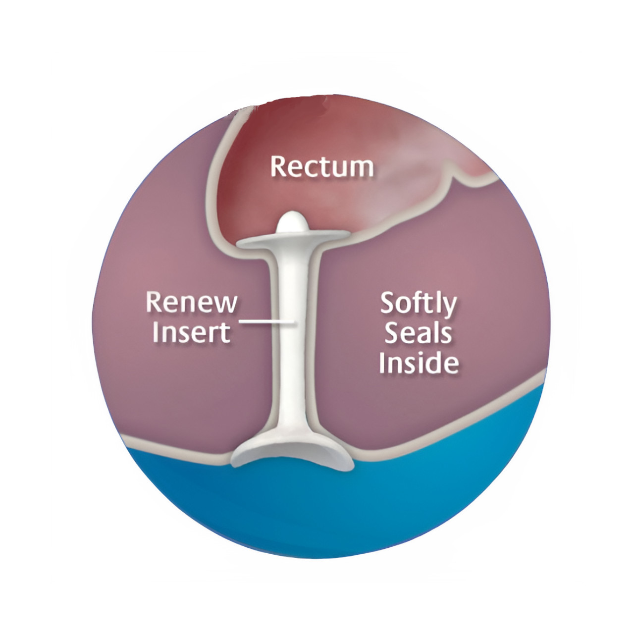 Medical Ostomy Supplies Australia | Alpha Medical Solutions