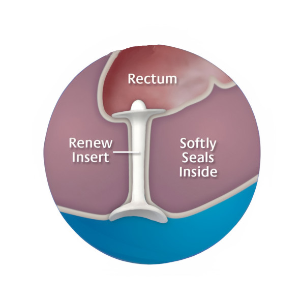 Medical Ostomy Supplies Australia | Alpha Medical Solutions