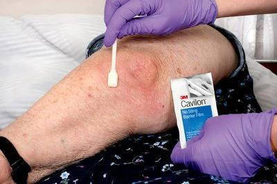 Cavilon Barrier Film Wand Applicator | 3mL