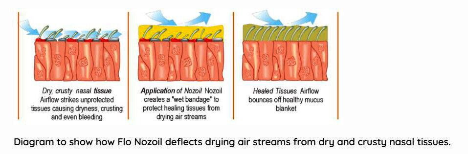 Flo Nozoil Nasal Spray 15mL: Ultimate Congestion Relief