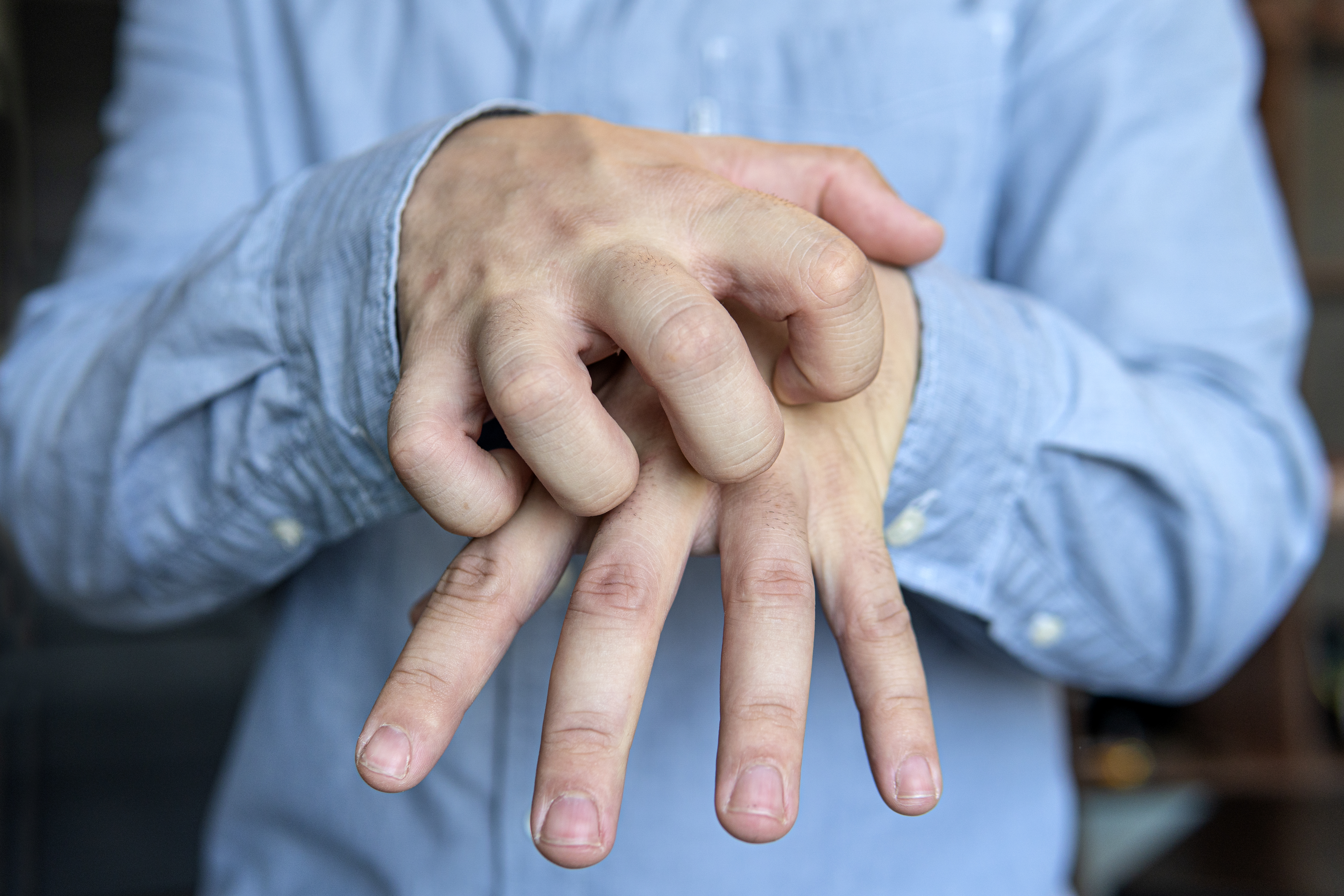 Scabies - SuperPharmacy Plus