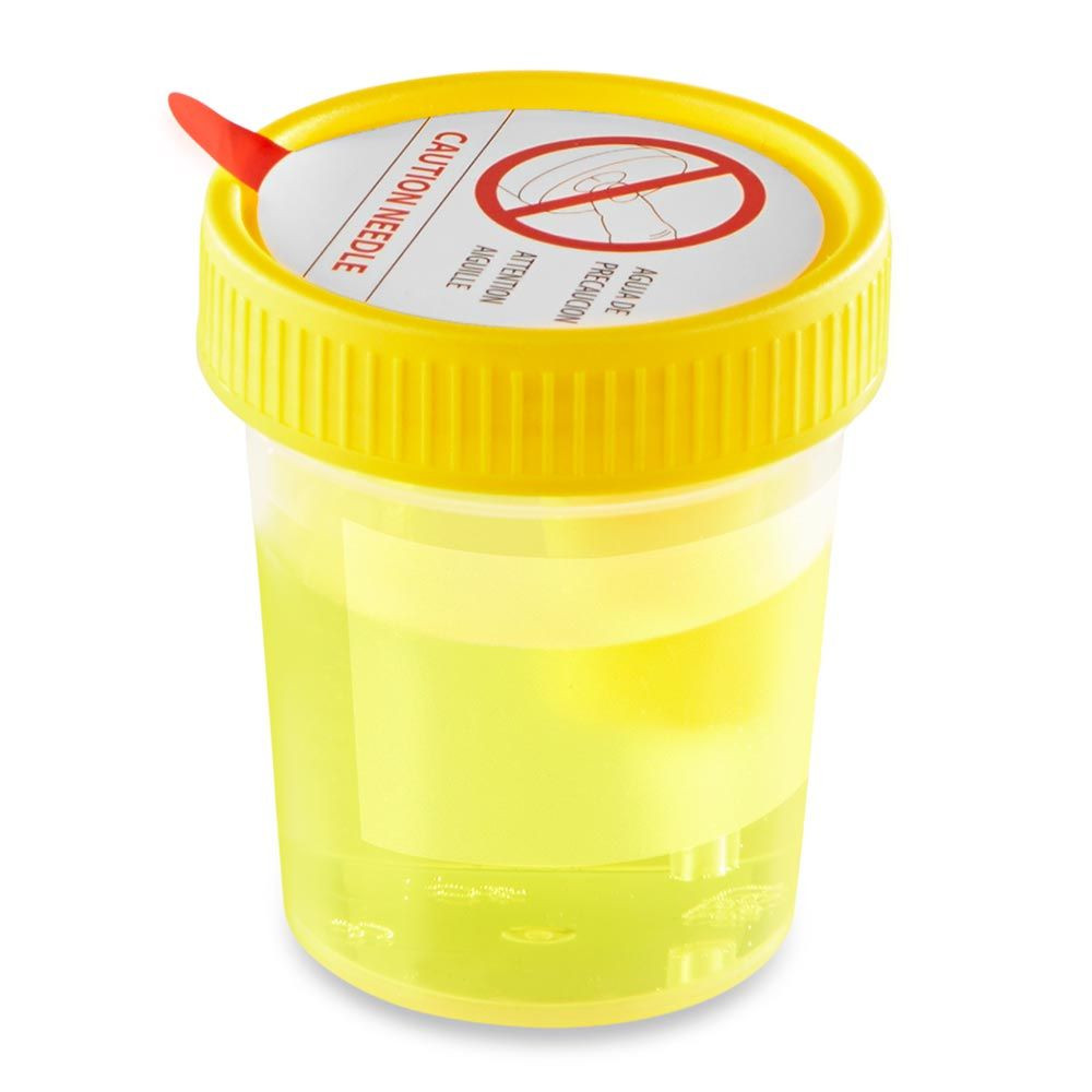 Urine Collection Cup with Integrated Direct Transfer Device for Vacuum ...