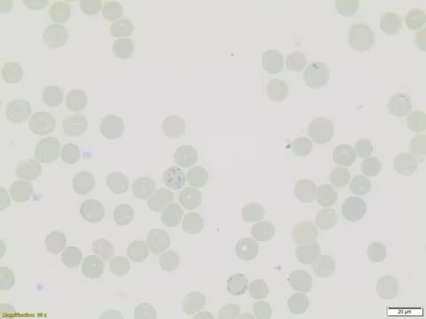 Reticulocyte Stain, 1 X 120 mL (R4132-120ML) | MilliporeSigma® (Sigma ...