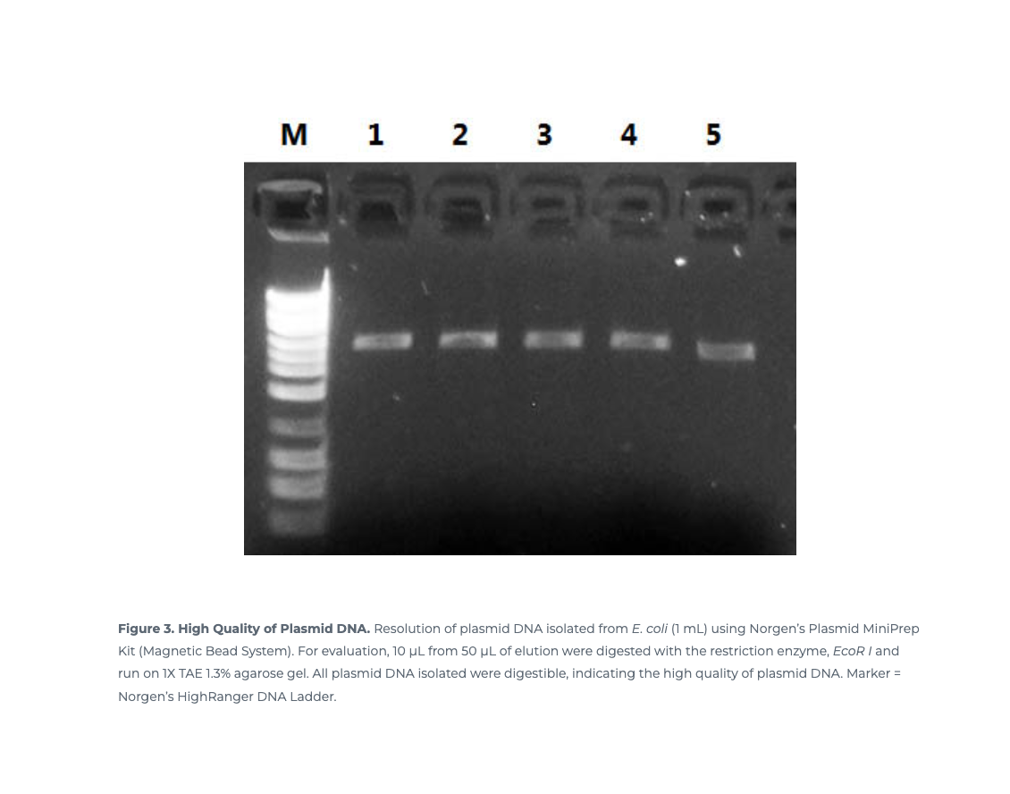 Norgen Biotek™ Plasmid MiniPrep 96-Well Plate Kit (Magnetic Bead System ...