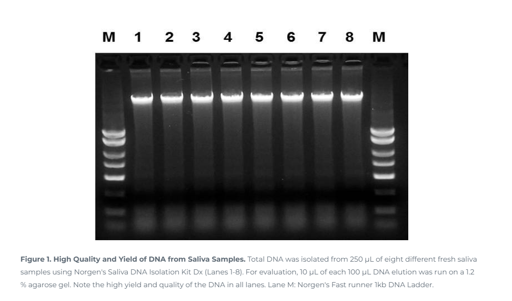 Norgen Biotek™ Saliva DNA Isolation Spin Column Kit Dx, 50 Preps