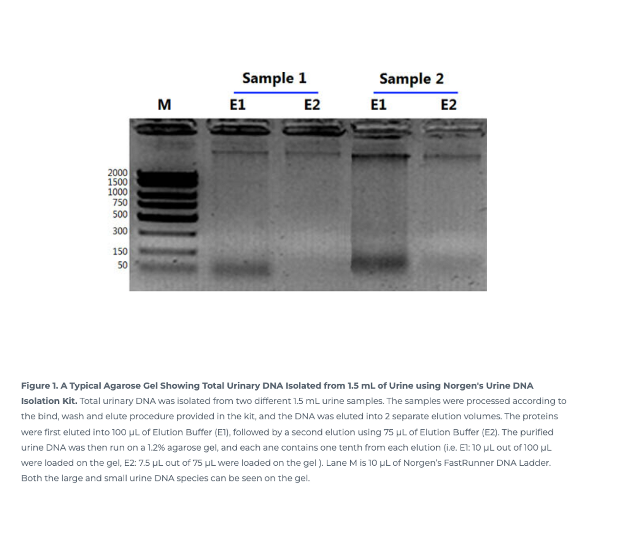 Norgen Biotek™ Urine DNA Isolation Spin Column Kit, 50 Preps