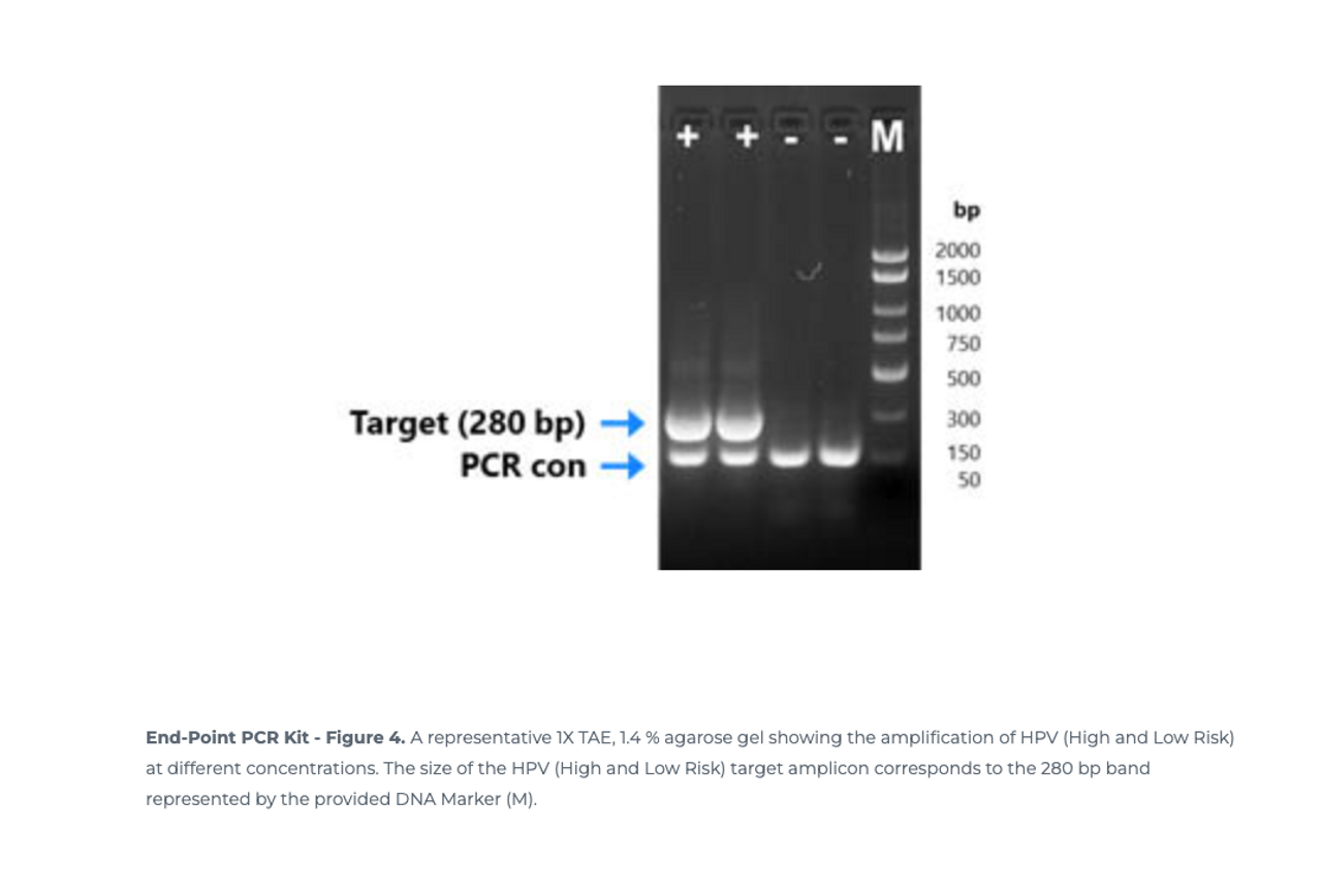 Norgen Biotek™ HPV High and Low Risk TaqMan PCR Kit, 100 Reactions