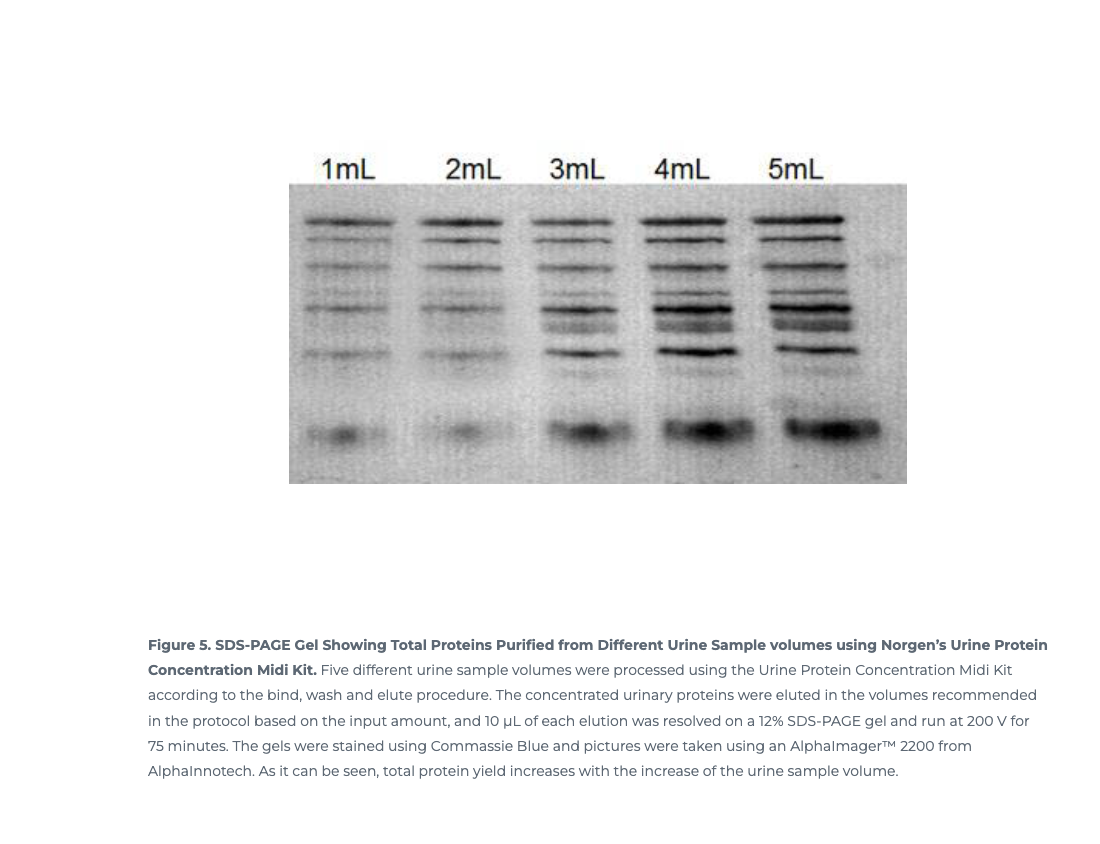 Norgen Biotek™ ProteoSpin™ Urine Protein Concentration Midi Spin Column ...
