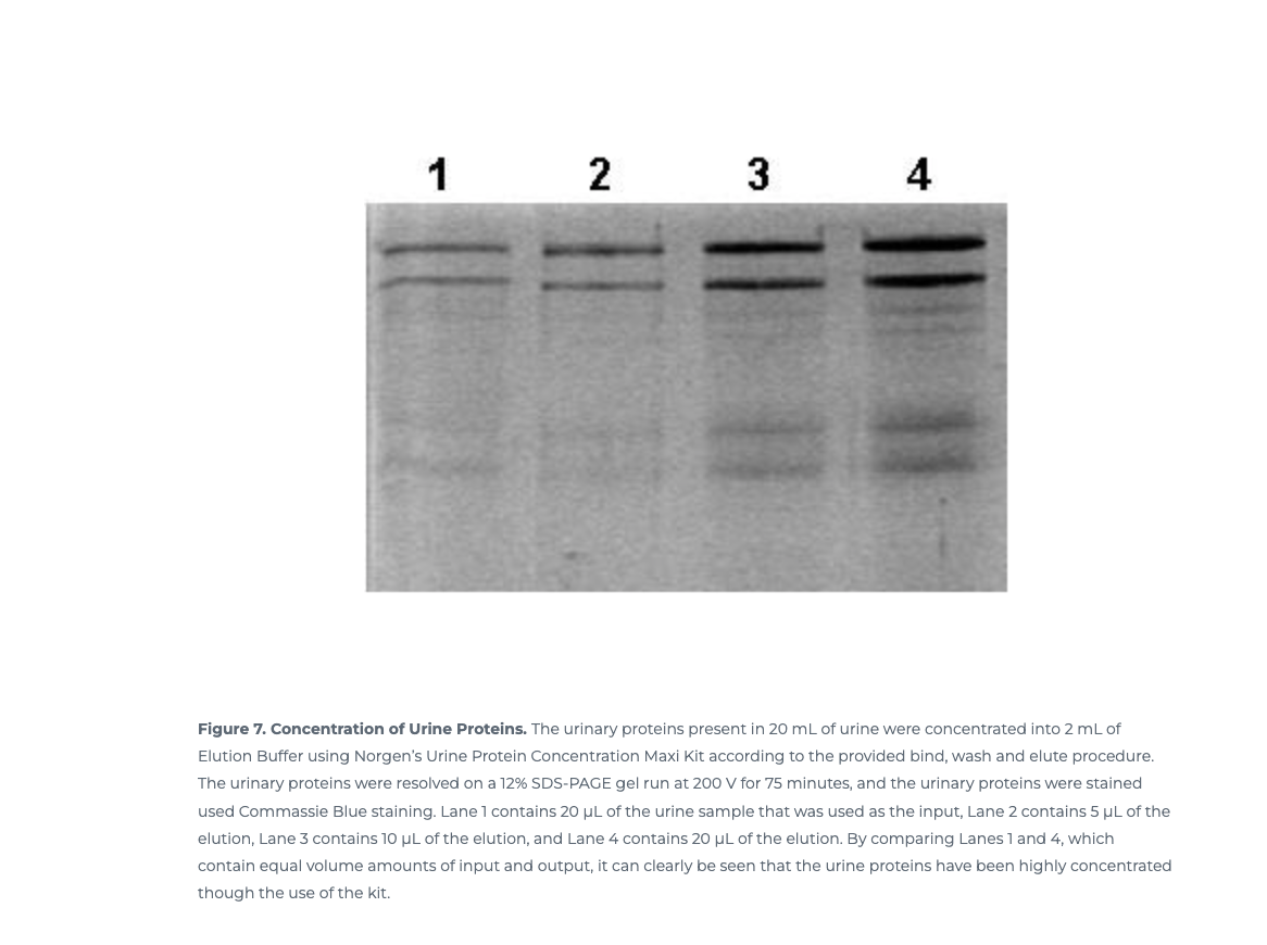 Norgen Biotek™ ProteoSpin™ Urine Protein Concentration Midi Spin Column ...