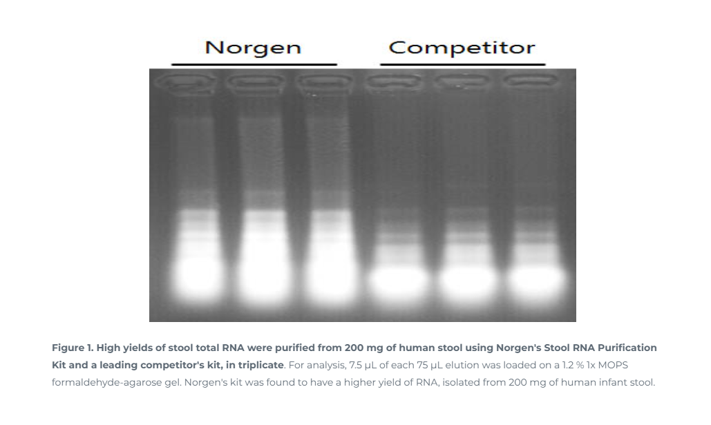 Norgen Biotek™ Stool Total RNA Purification Kit, 50 Preps
