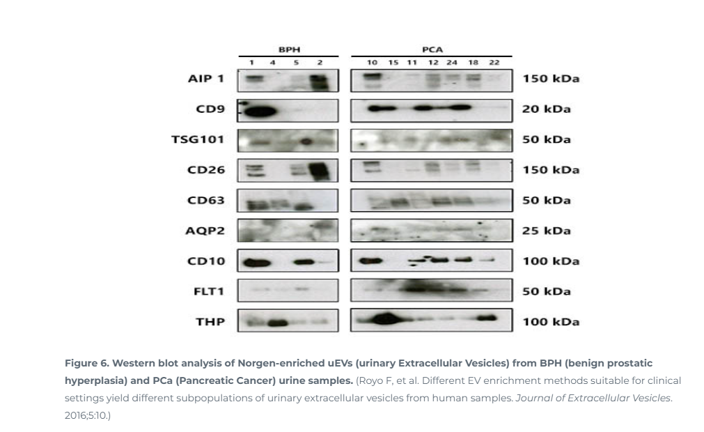 Norgen Biotek™ Urine Exosome RNA Isolation Kit Spin Column, 50 Preps