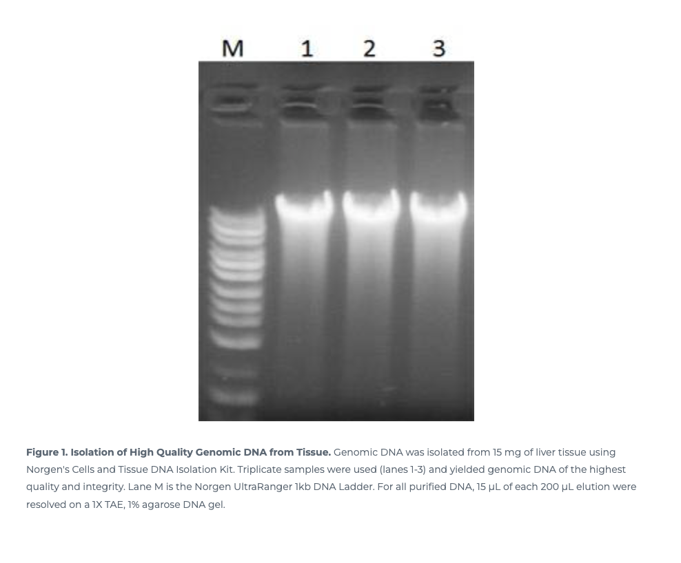 Norgen Biotek™ Cells and Tissue DNA Isolation 96-Well Kit (Magnetic ...