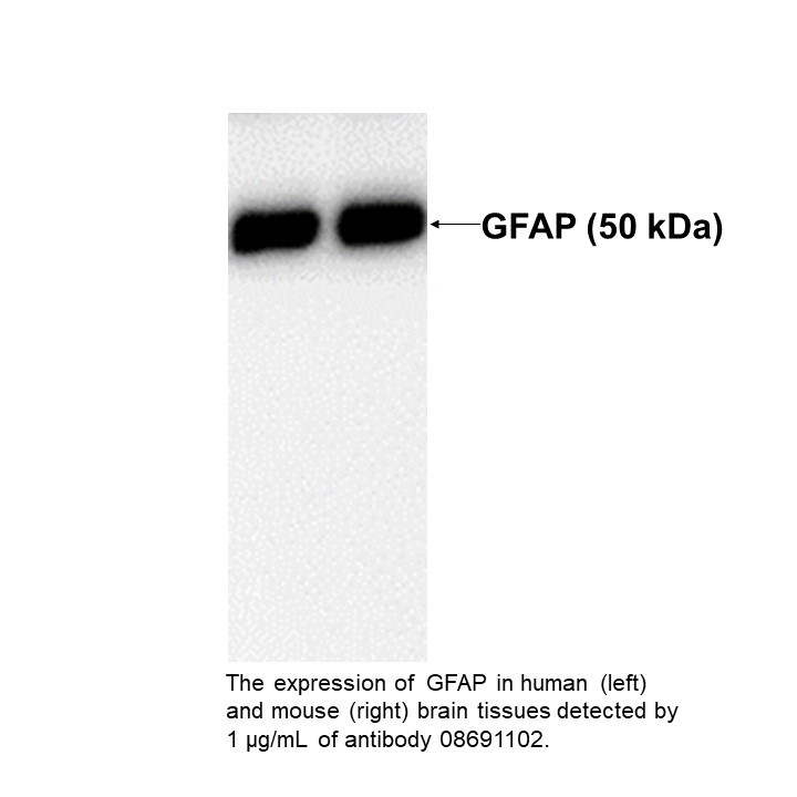 Anti-glial fibrillary acidic protein (GFAP) mouse monoclonal | MP ...