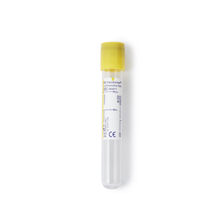 BD® 365017 Vacutainer™ Urine Collection System Urinalysis Tube, 16 x ...