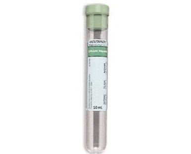 sodium citrate tube blood volume