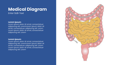 Medical Diagram - Intestine on right - 2 Steps