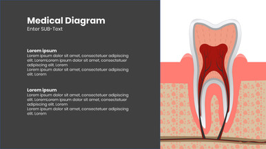 Medical Diagram with root canal of teeth