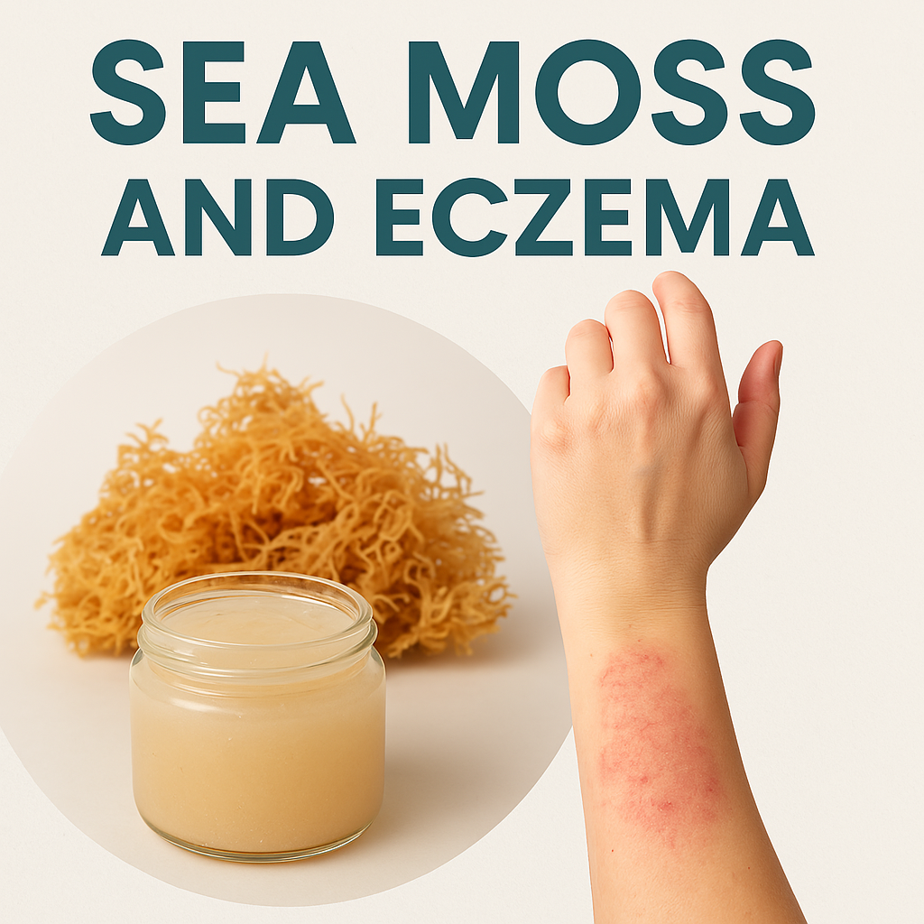 The Benefits of Sea Moss Cream for Eczema | Natural Skincare - Africa ...