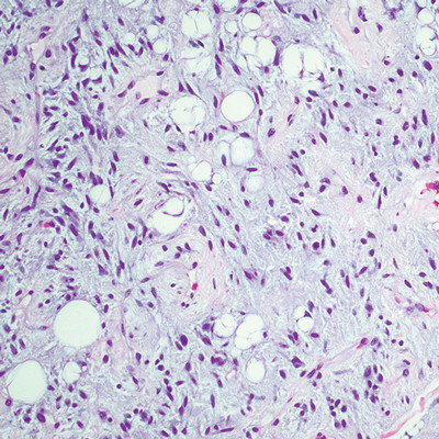 Soft Tissue Pathology CME | Cleveland Clinic