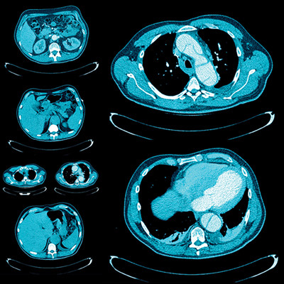 UCSF Abdominal and Thoracic Imaging | Radiology CME