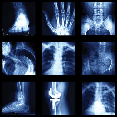UCSF Imaging: Core and Extremities - Oakstone | CME