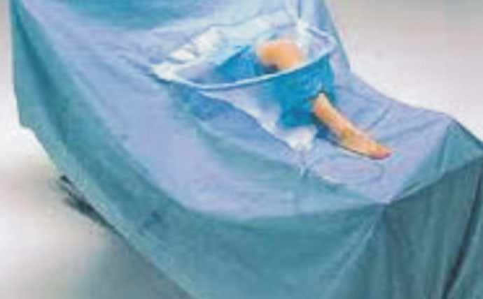 Arthroscopy Drape. - Docuses Healthcare
