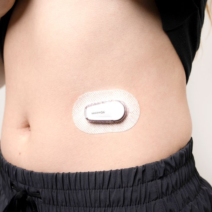 Dexcom G6 Transmitter for Continuous Glucose Monitoring CGM - Medical ...