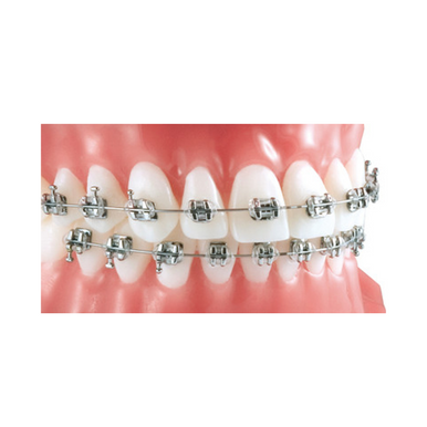 Bracket metálico BIONIC™ Técnica Roth - Dental de Venta Directa SA (PT ...