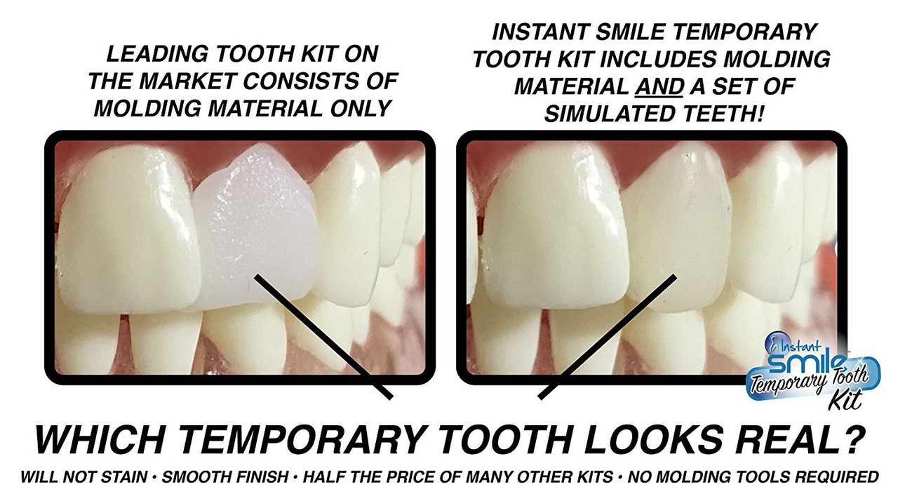 Instant Smile Temporary Tooth Kit by Billly Bob Teeth - CostumeVille