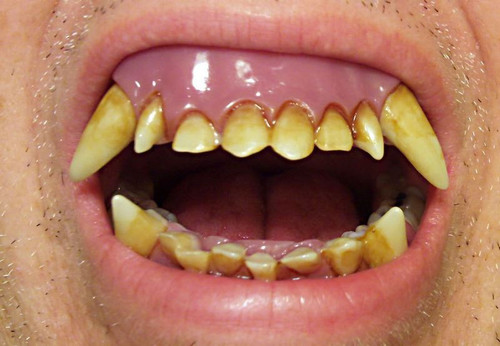 Dental Distortions Evil Clown Teeth Pennywise Grimm Grell Orc Minion ...