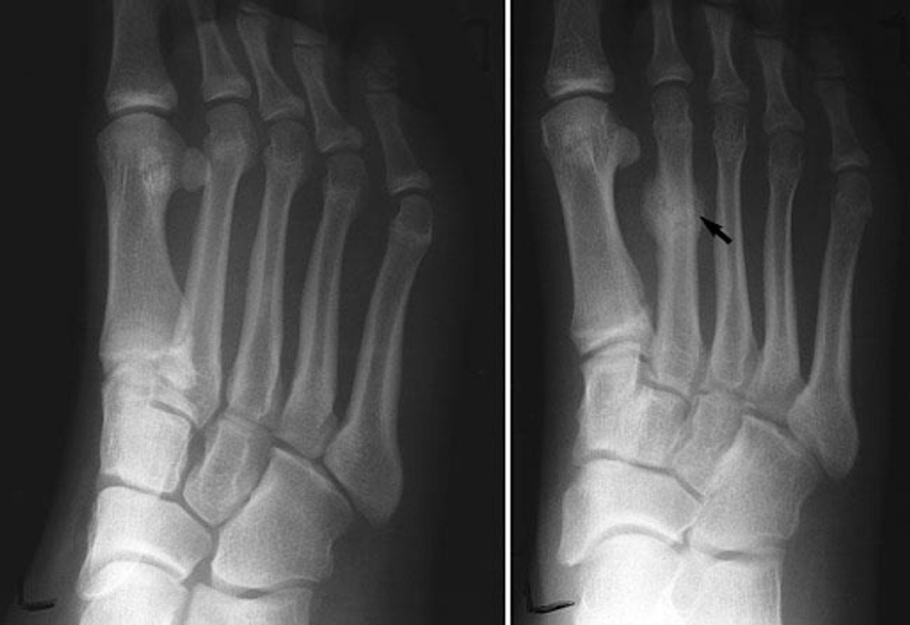 Foot Pain Foot Problem Or Something Else Orthotics Direct foot-pain-foot-problem-or-something-else-orthotics-direct