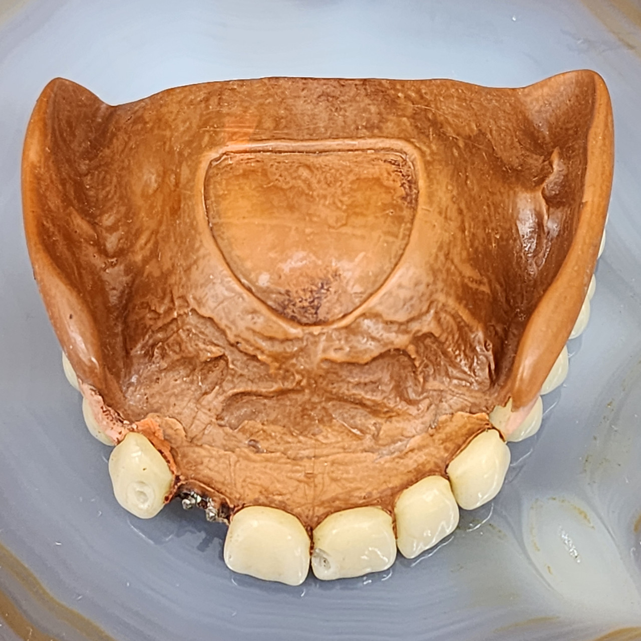 Antique Estate Found Dentures Upper Plate False Teeth w/ Repairs ...