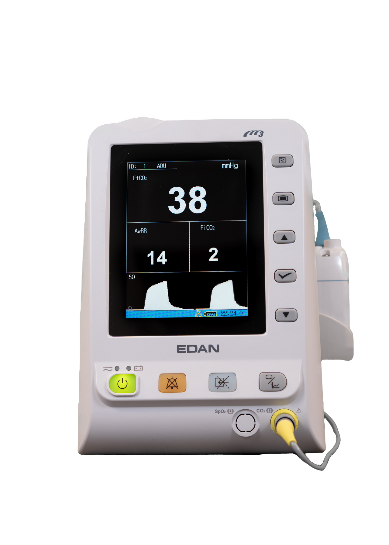 Patient Monitors