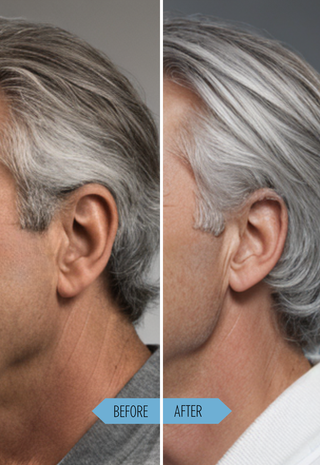 Gray Hair Shampoo 8 Oz Gray Hair Just Nutritive