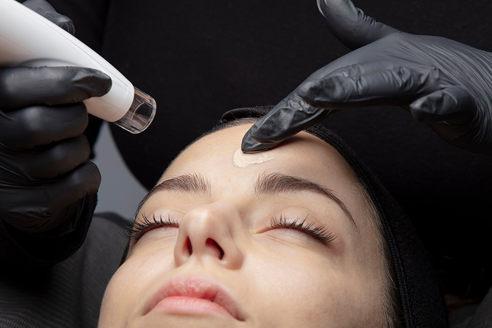 Microneedling for All: A Guide to Embracing This Treatment for Every ...