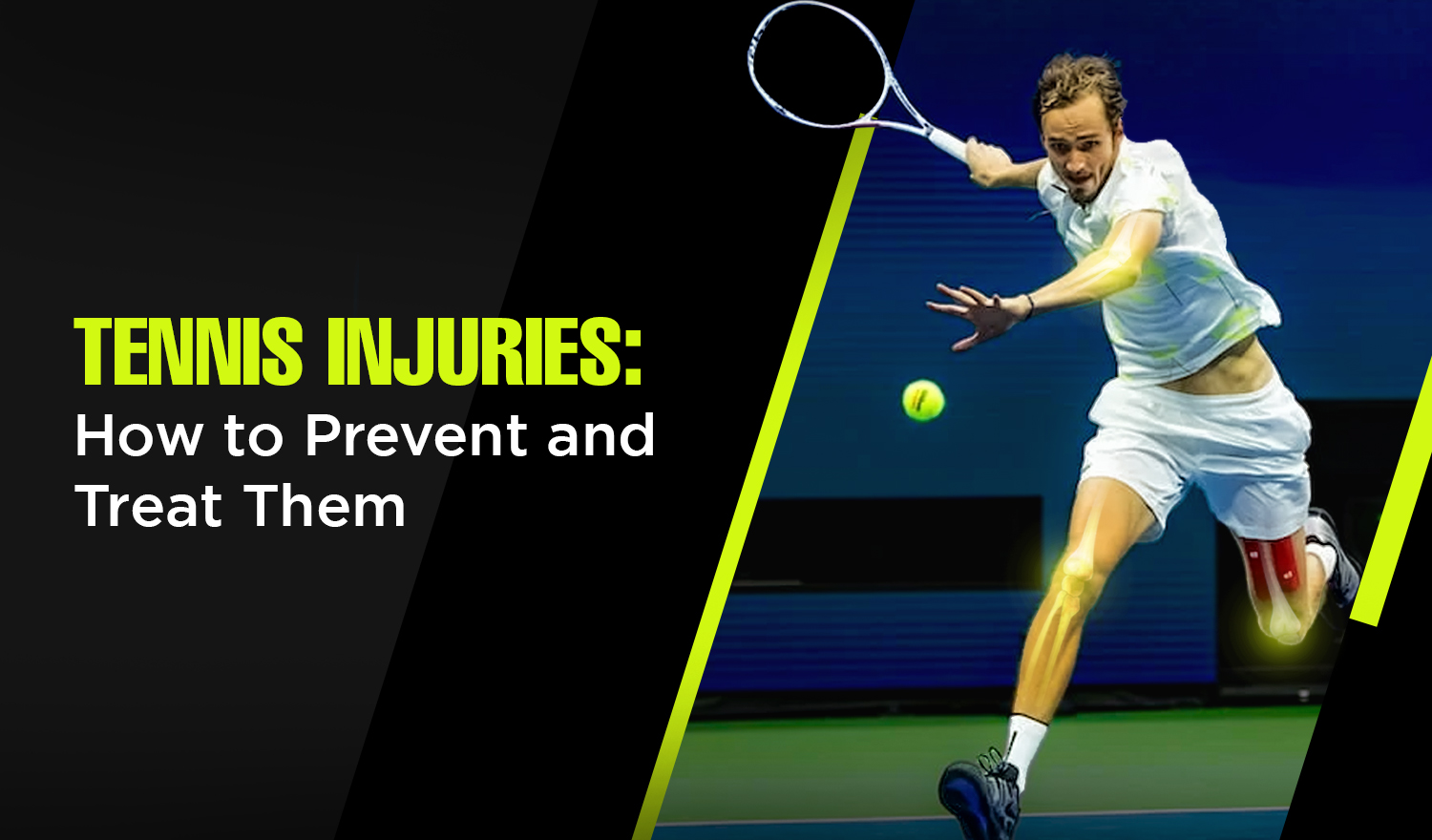 How to Prevent Tennis Injuries & Stay Injury-Free - TennisShop.ae