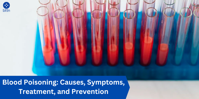 Blood Poisoning: Causes, Symptoms, Treatment, and Prevention - bttn