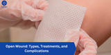 Open Wound: Types, Treatments, and Complications - bttn