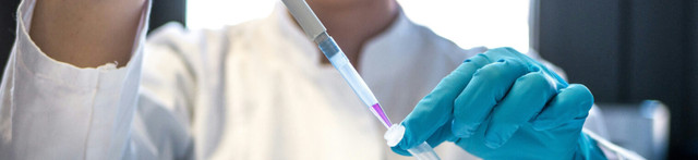 MPV Blood Test: What You Need to Know About Your Results - bttn