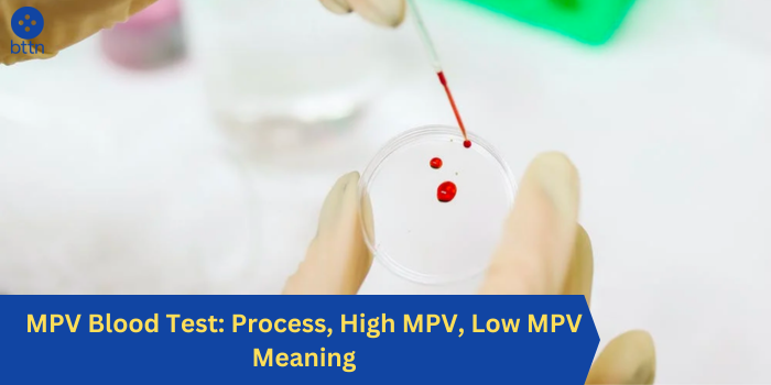 MPV Blood Test: What You Need to Know About Your Results - bttn