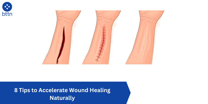 8 Tips to Accelerate Wound Healing Naturally - bttn