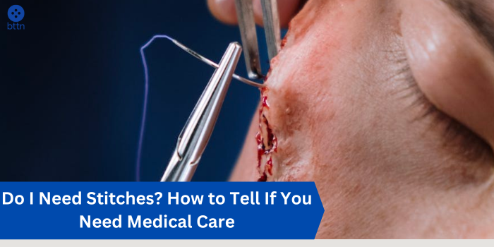Do I Need Stitches? How to Tell If You Need Medical Care - bttn
