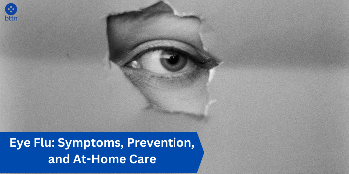Eye Flu: Symptoms, Prevention, and At-Home Care - bttn