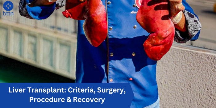Liver Transplant: Criteria, Surgery, Procedure & Recovery - bttn