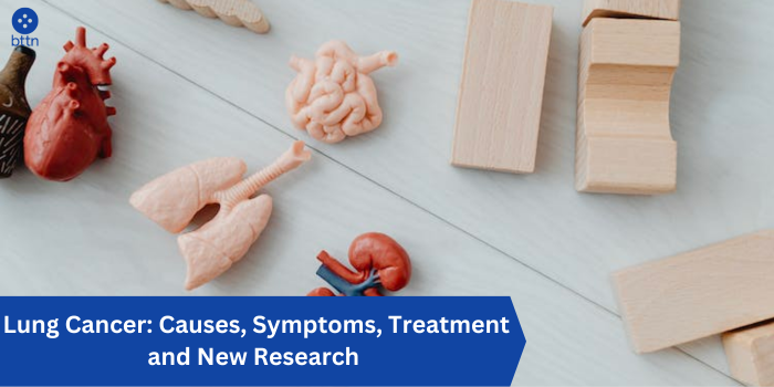 Lung Cancer: Causes, Symptoms, Treatment and New Research - bttn